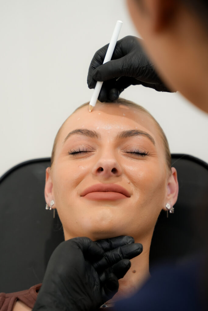 Upper Face Wrinkle Reducer Treatment: Purpose, Benefits & Results ...